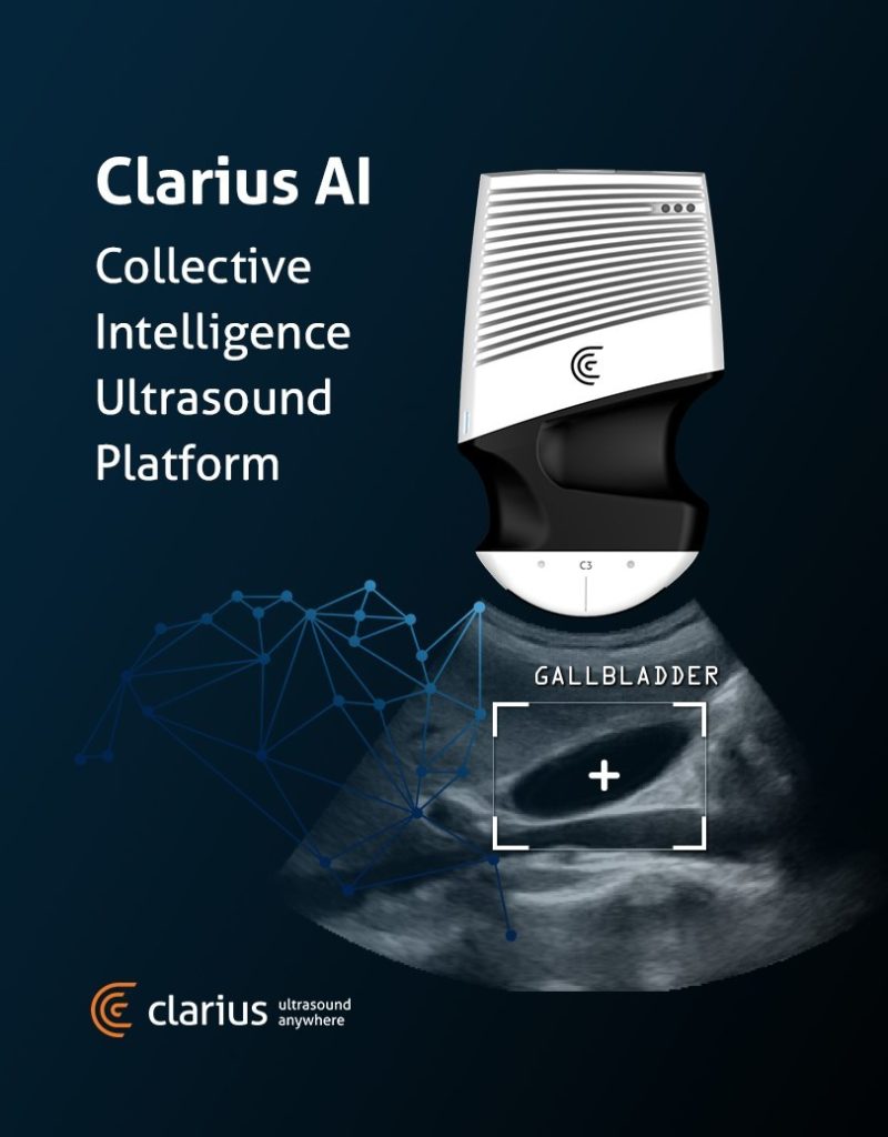 Clarius Mobile Health Announces Clarius AI: Collective Intelligence Ultrasound Platform | Clarius