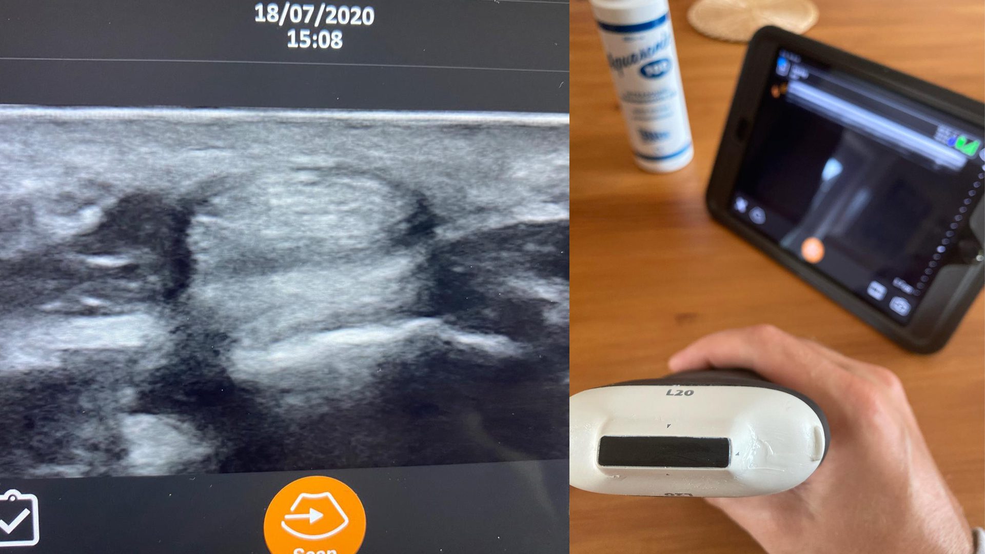 New Clarius Machines Take Image Quality of Handheld Ultrasound to the ...