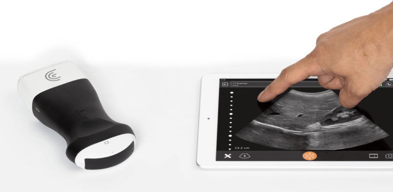 Schedule a Live 1-On-1 Handheld Ultrasound Demo - Clarius Mobile Health