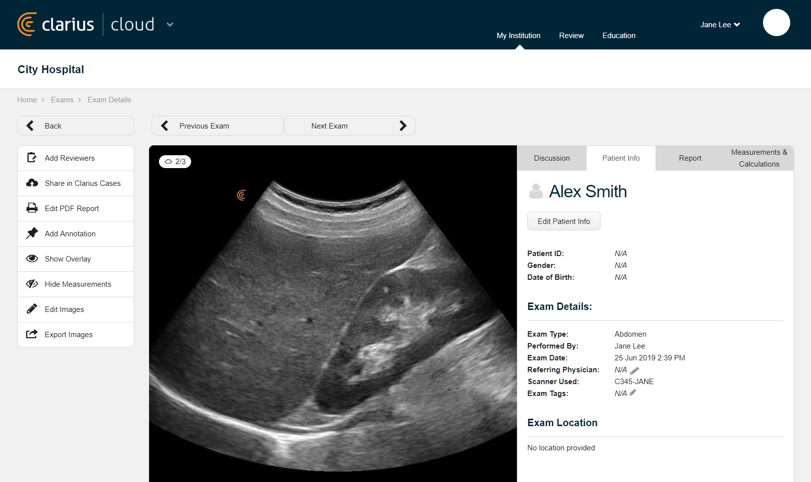 7 Ways Clarius Cloud Can Help You Better Manage Ultrasound Exams ...
