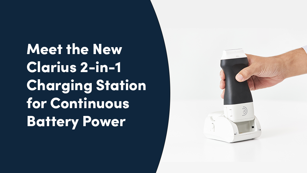 Wishing for Continuous Battery Power for your Handheld Ultrasound ...