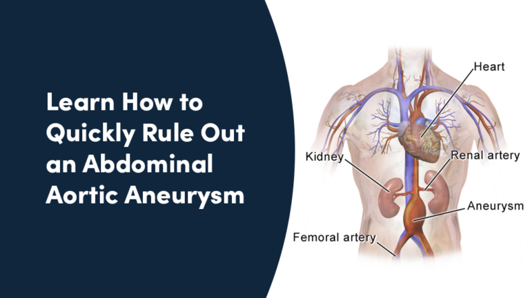 [VIDEO] Learn How to Quickly Rule Out an Abdominal Aortic Aneurysm ...