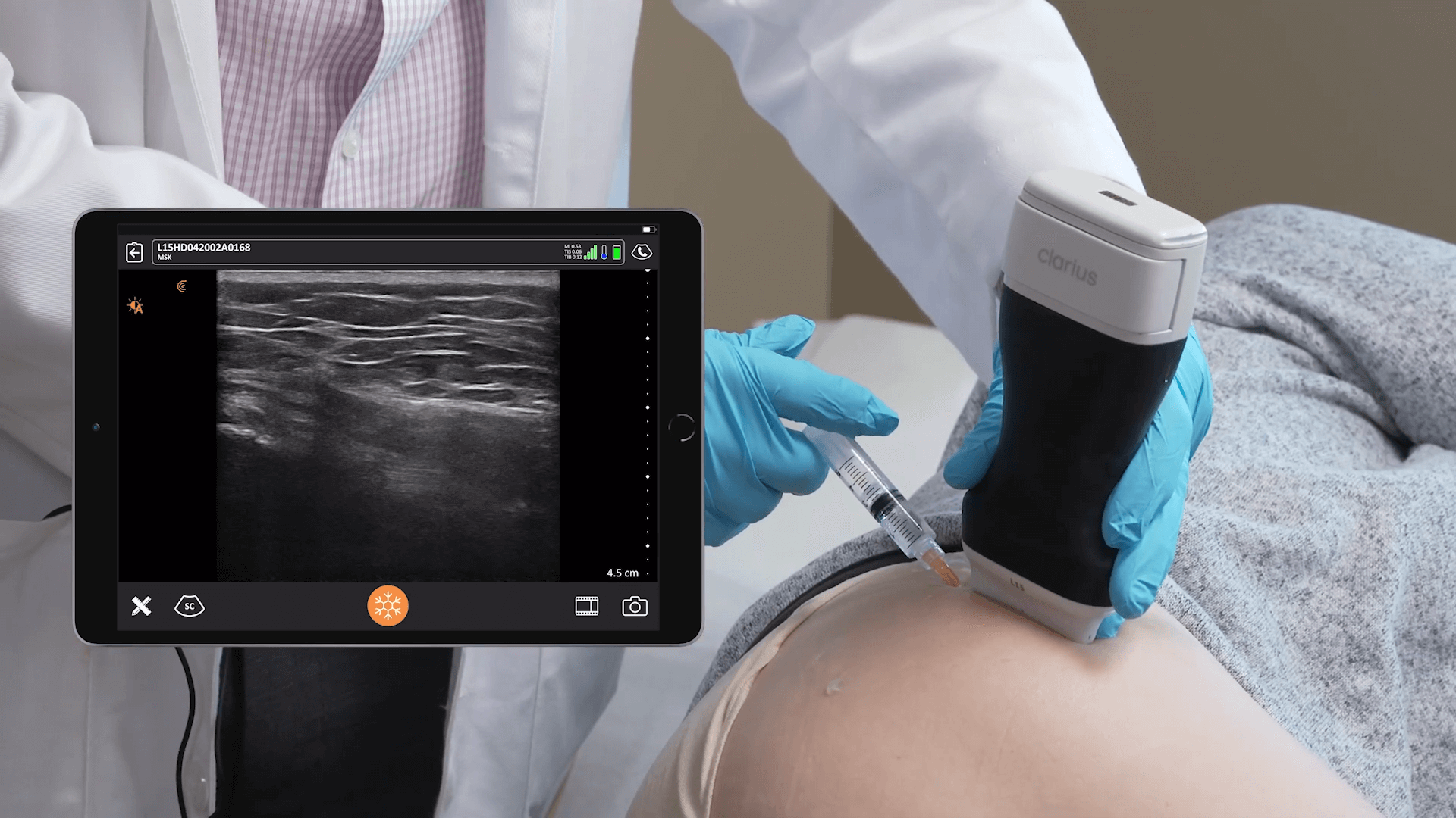 Gluteal Tendon Injection - Clarius Mobile Health