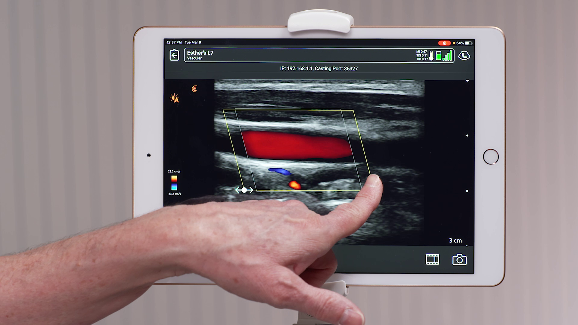 Color Doppler Mode - Clarius Mobile Health