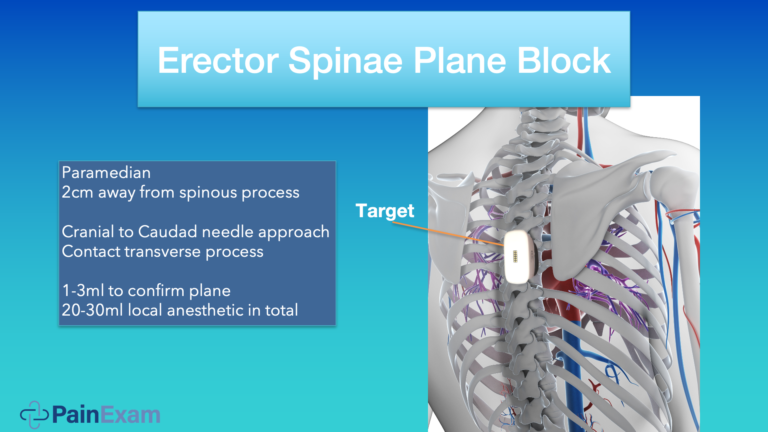 [VIDEO] Ultrasound-Guided Pain Injections: Treating Severe Chronic Neck ...