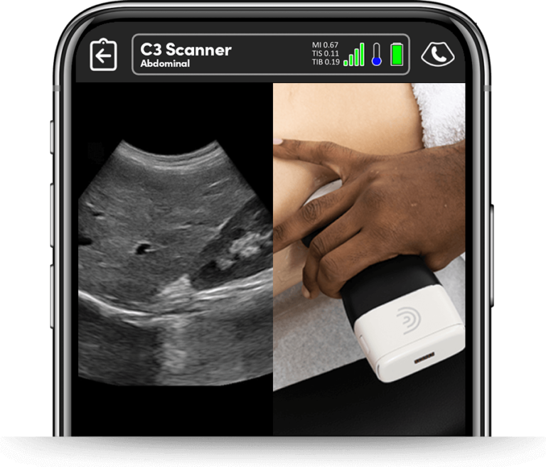 We’re Turbocharging Clarius Ultrasound Scanners with Our Latest V8.0 ...