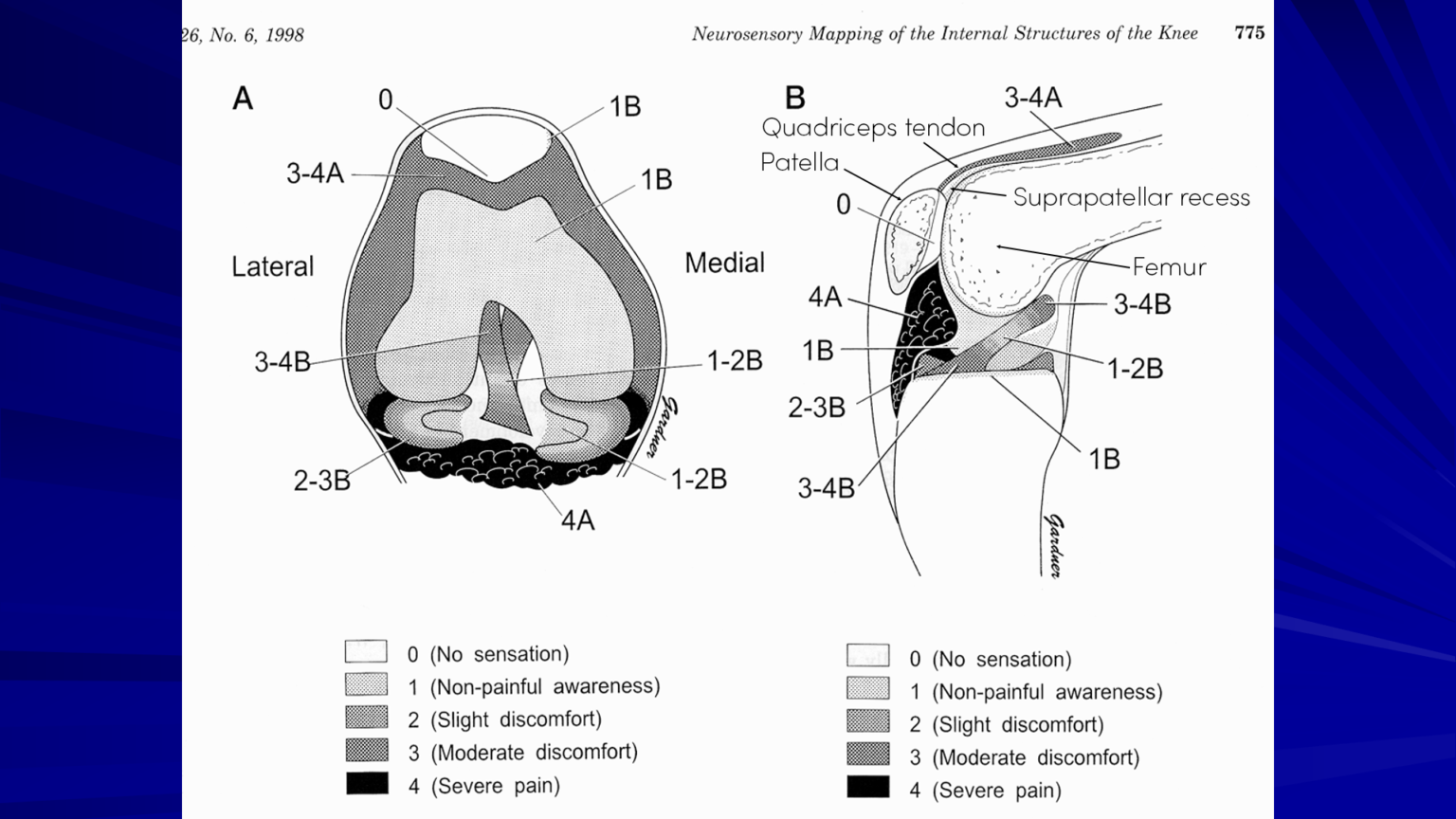 [VIDEO] Using Ultrasound to Guide Intra-Articular Injections of the ...