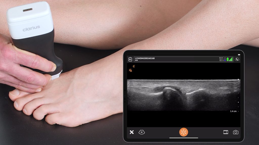 Clarius Introduces Wireless Veterinary Ultrasound Scanner | Clarius