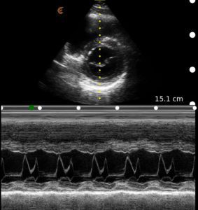 Phased Array Scanner | Clarius