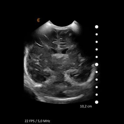 Clarius HD Portable Ultrasound Machine | Clarius