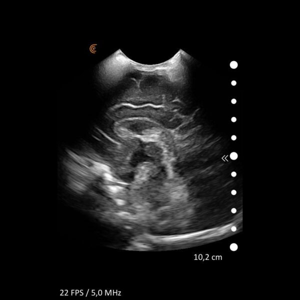 Clarius HD Portable Ultrasound Machine | Clarius