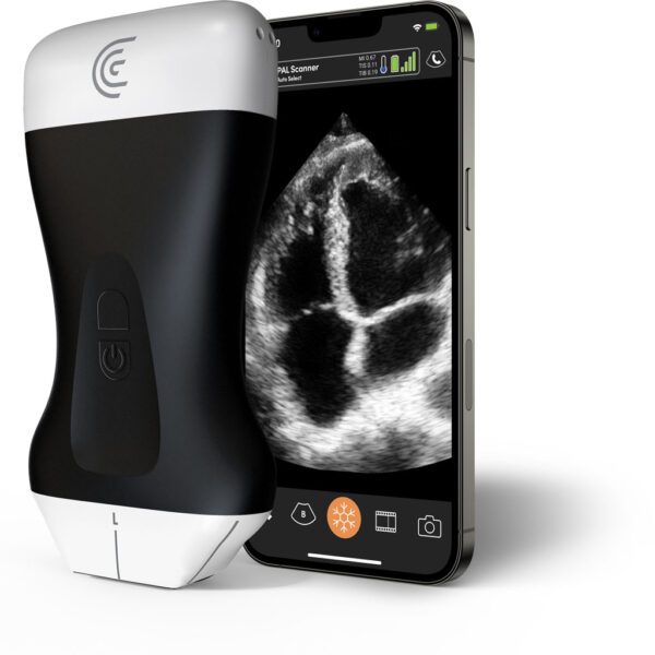 Bedside Ultrasound for Critical Care | Clarius Portable Scanners