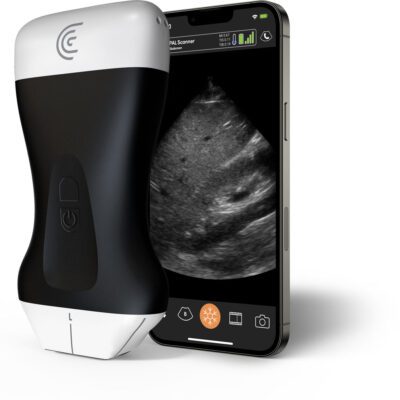 Wireless Ultrasound for Hospitalists | Clarius High-Definition Wireless ...