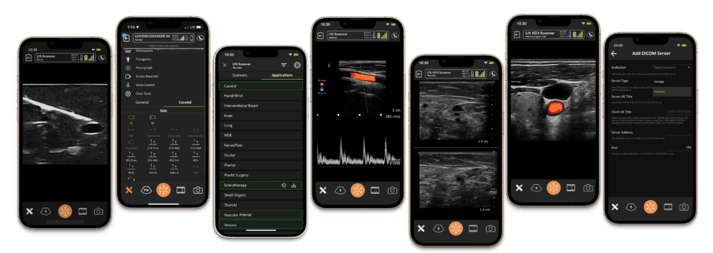 Vascular Access | Clarius