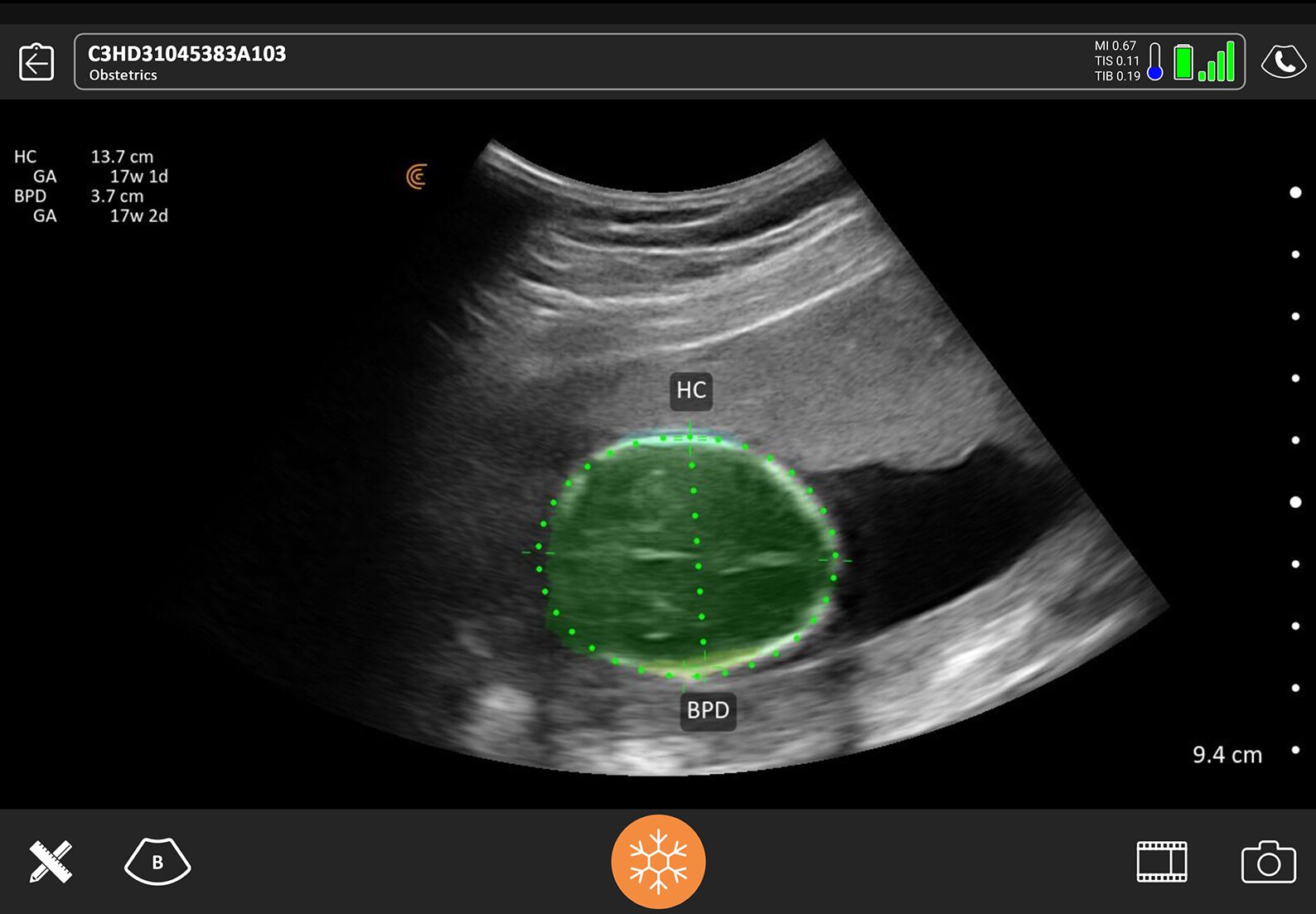 POCUS: Point of Care Ultrasound for Primary Care | Clarius