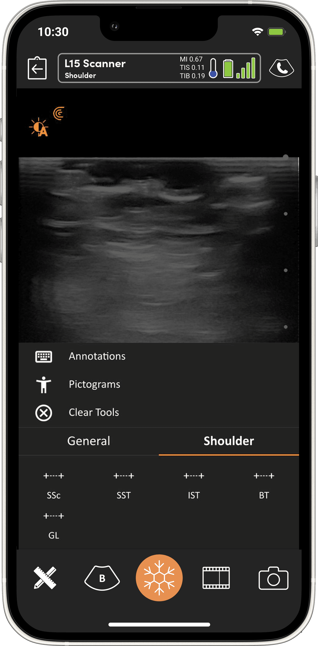 Advanced MSK Package | Clarius