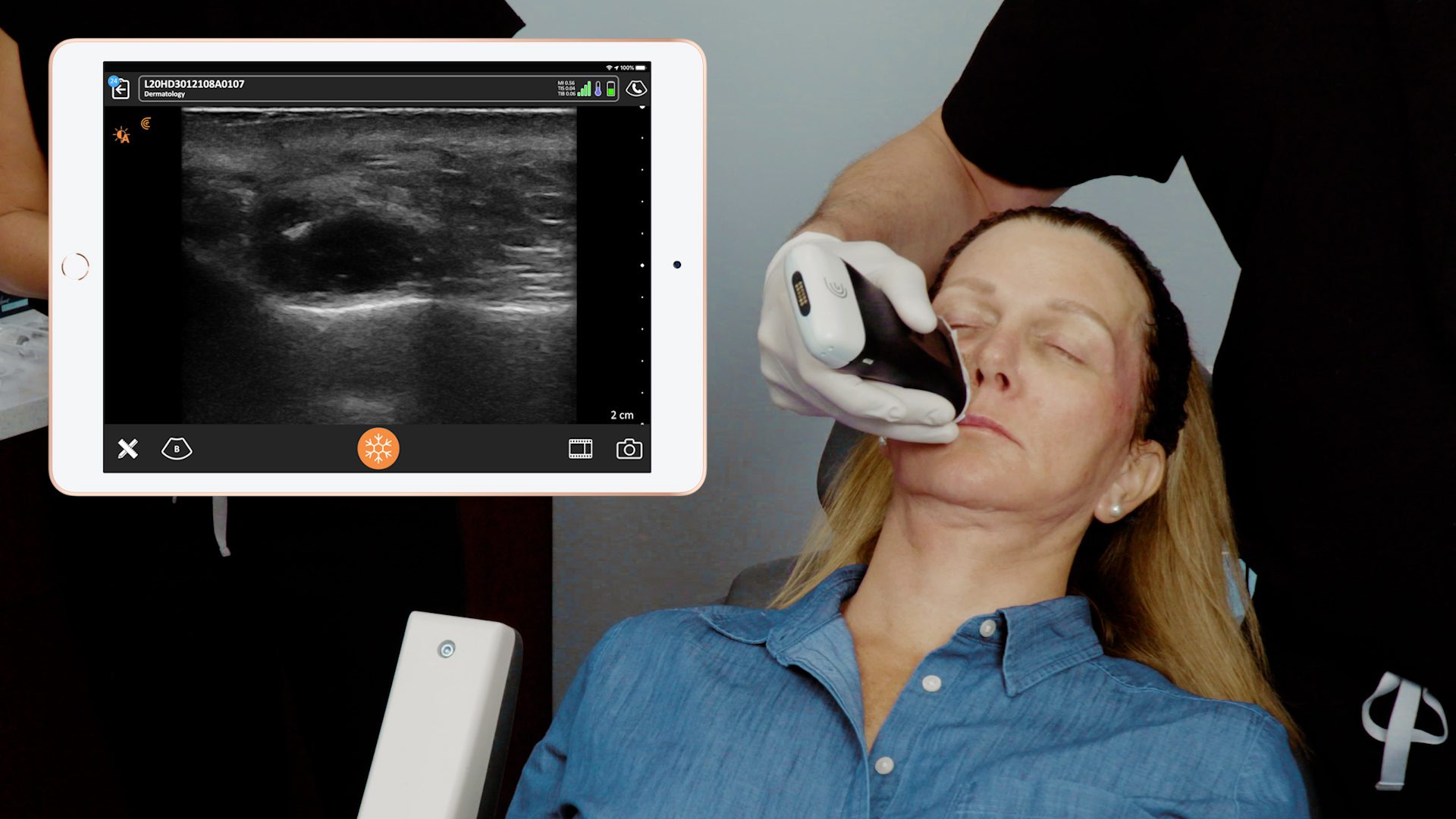 7 Reasons to Use the New Clarius Ultrasound for Your Facial Aesthetics ...