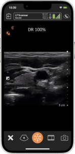 Advanced Features | Clarius