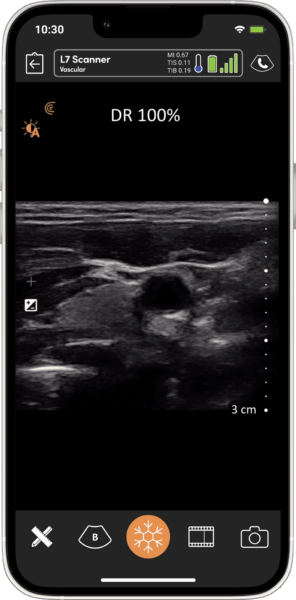 Advanced Features | Clarius