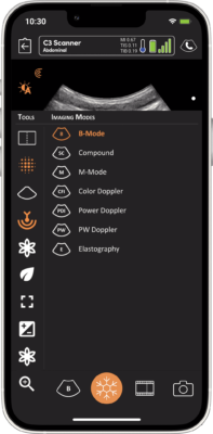 Advanced Features | Clarius