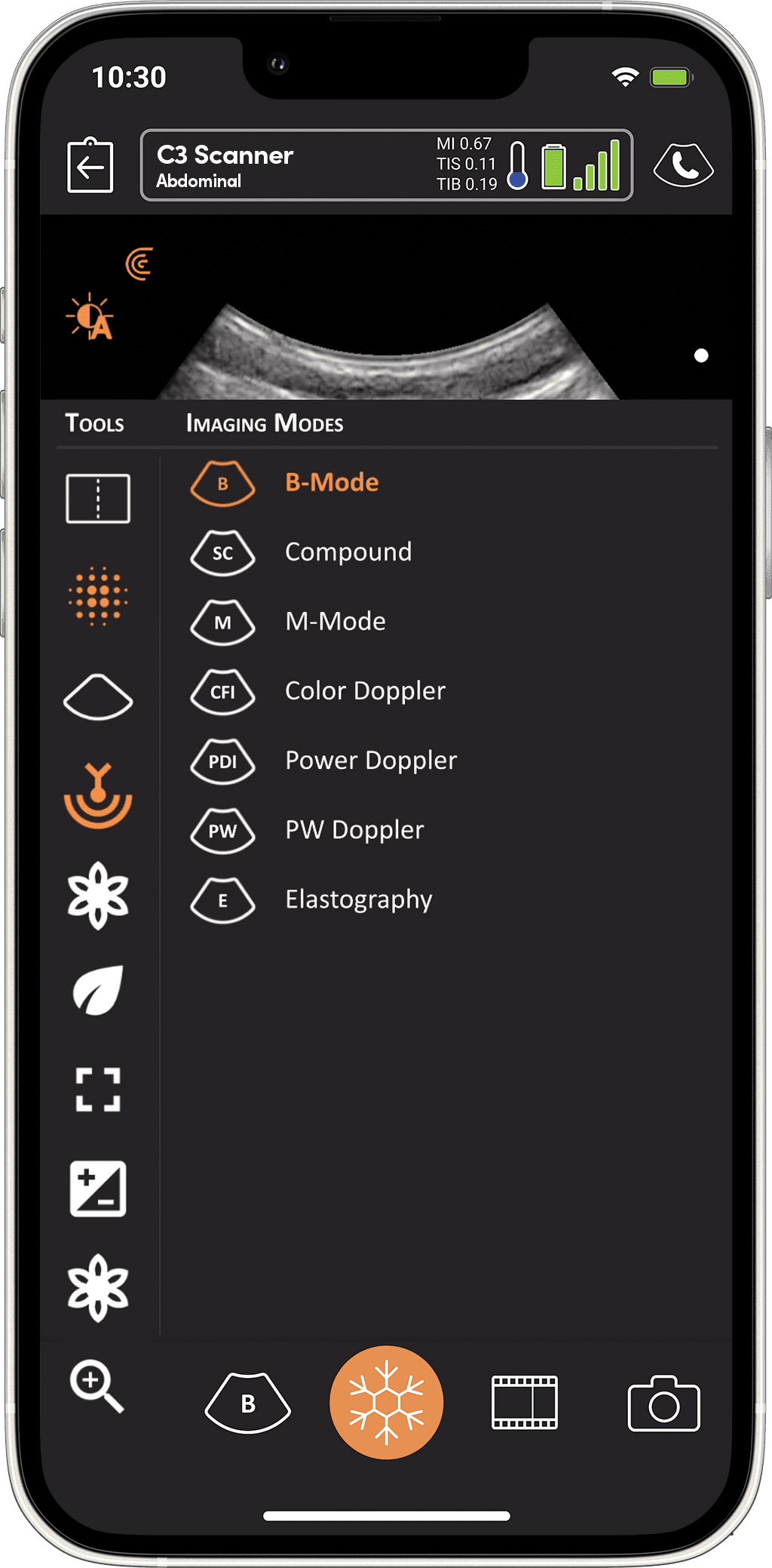 Advanced Features | Clarius
