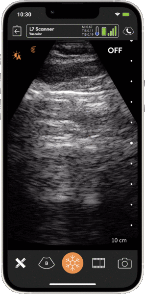 Advanced Features | Clarius