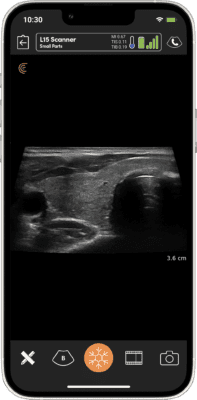 Advanced Features | Clarius