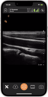 Advanced Features | Clarius