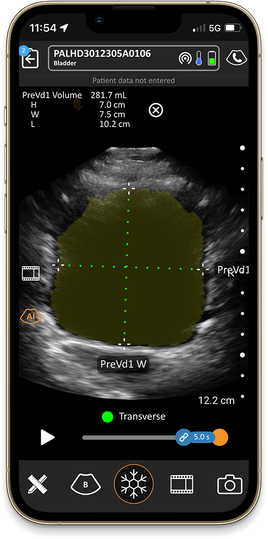 Clarius AI Ultrasound | Smart Imaging for Accurate Diagnostics