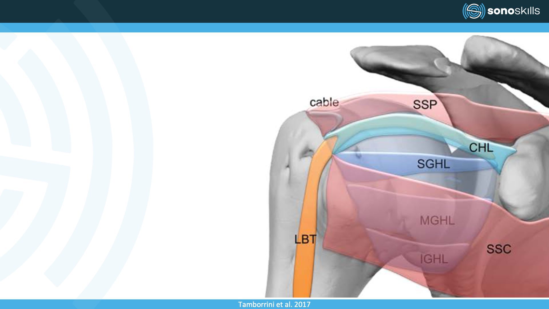 Learn to Scan the Rotator Interval and Identify Pathology | Clarius