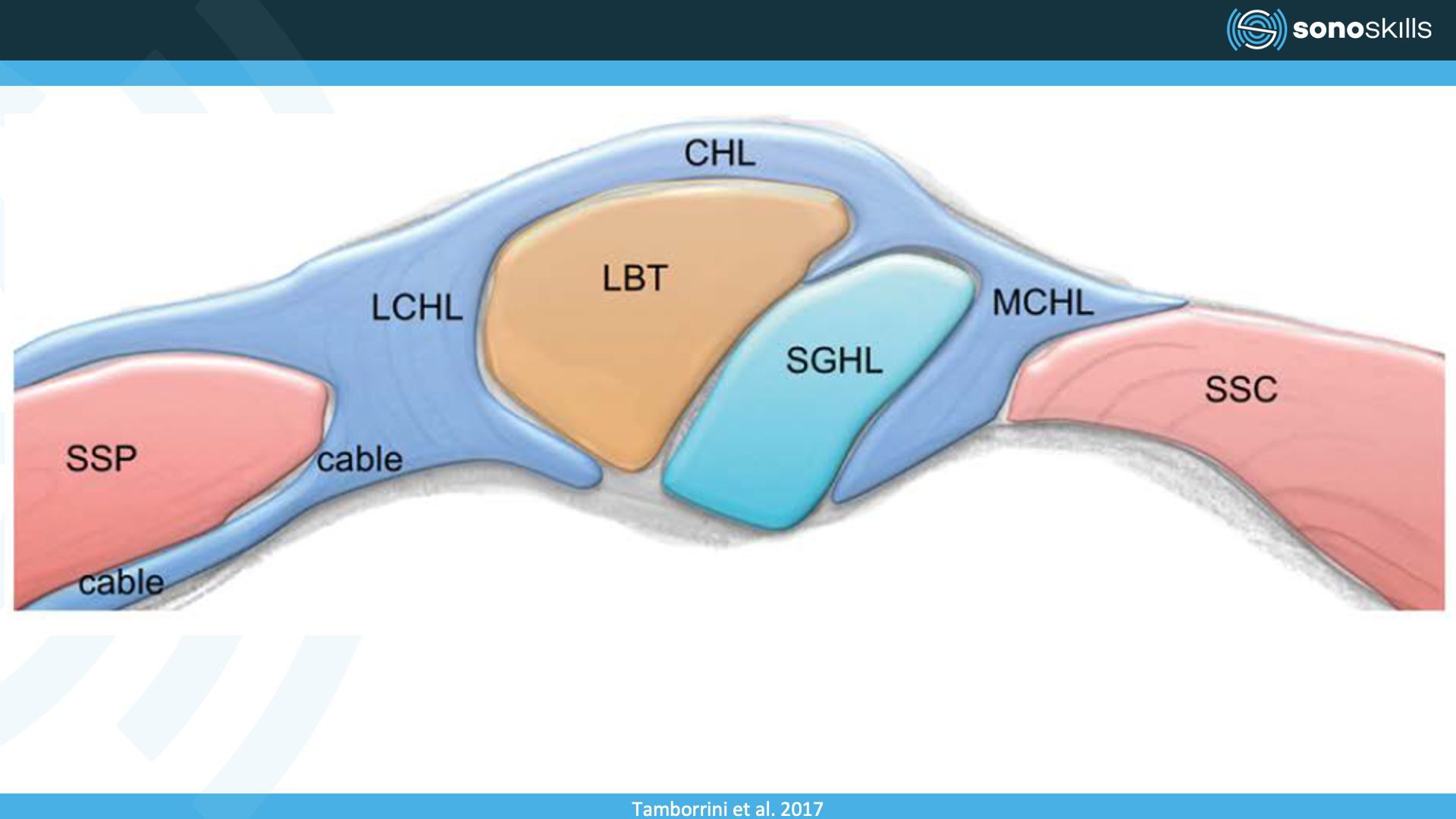 Learn to Scan the Rotator Interval and Identify Pathology | Clarius