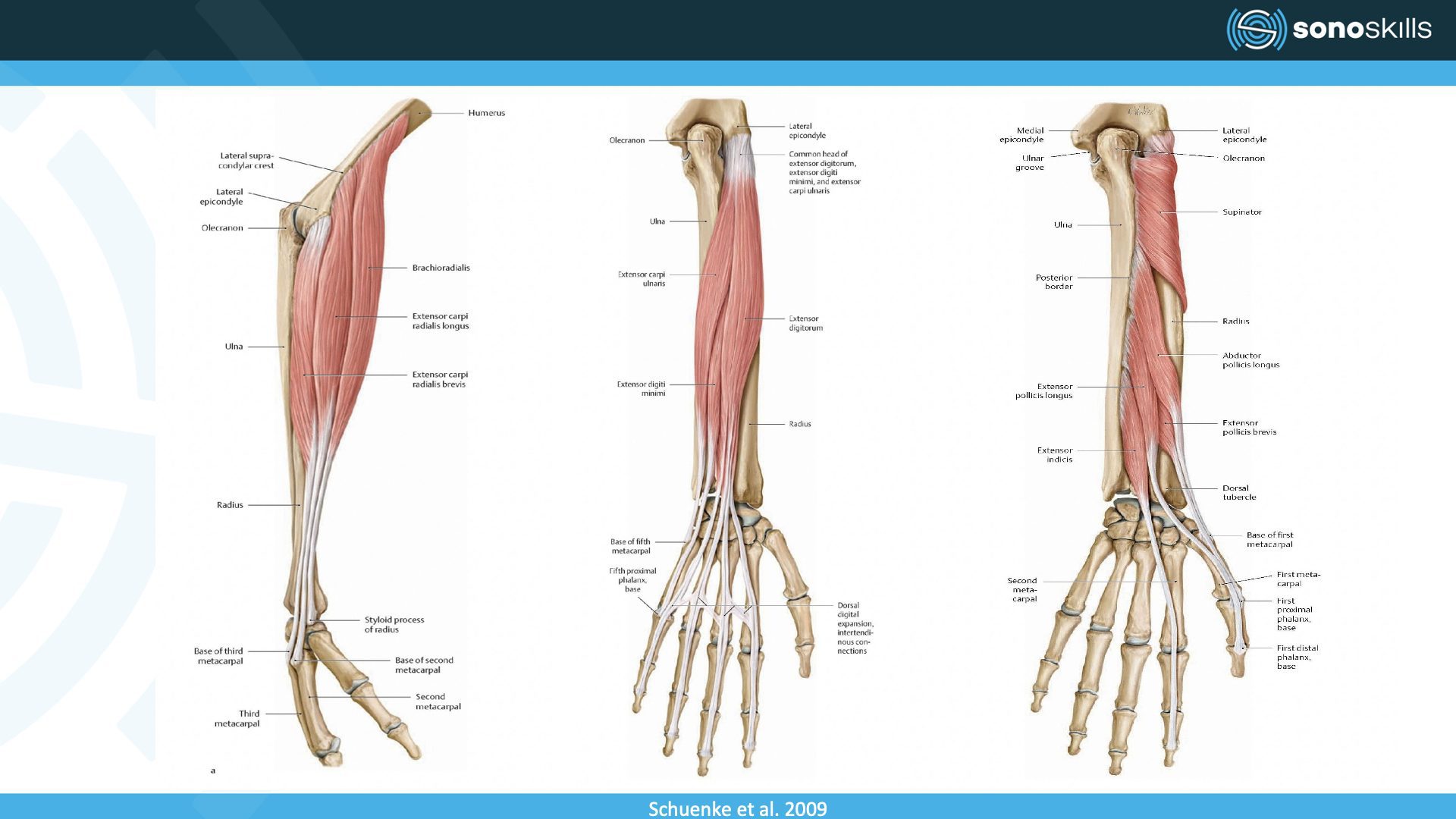Quickly Resolve Differential Diagnoses for MSK Injuries with Handheld ...