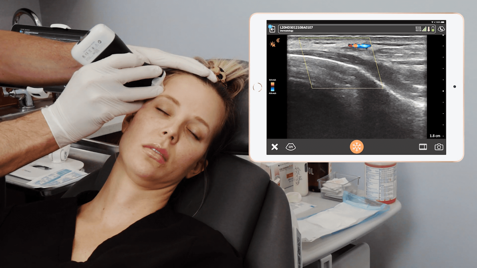 Vascular Mapping For Temporal Injection Clarius