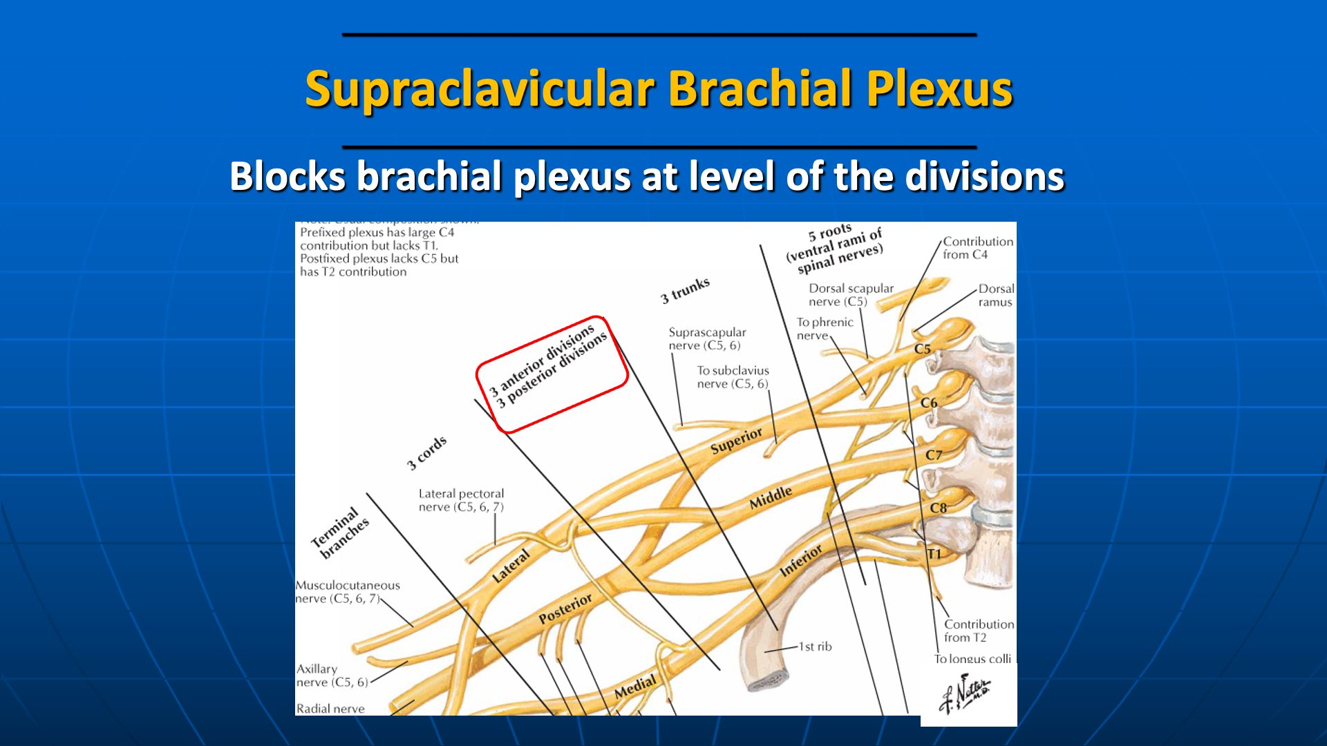 Learn How to Perform Ultrasound-Guided Brachial Plexus Blocks | Clarius ...