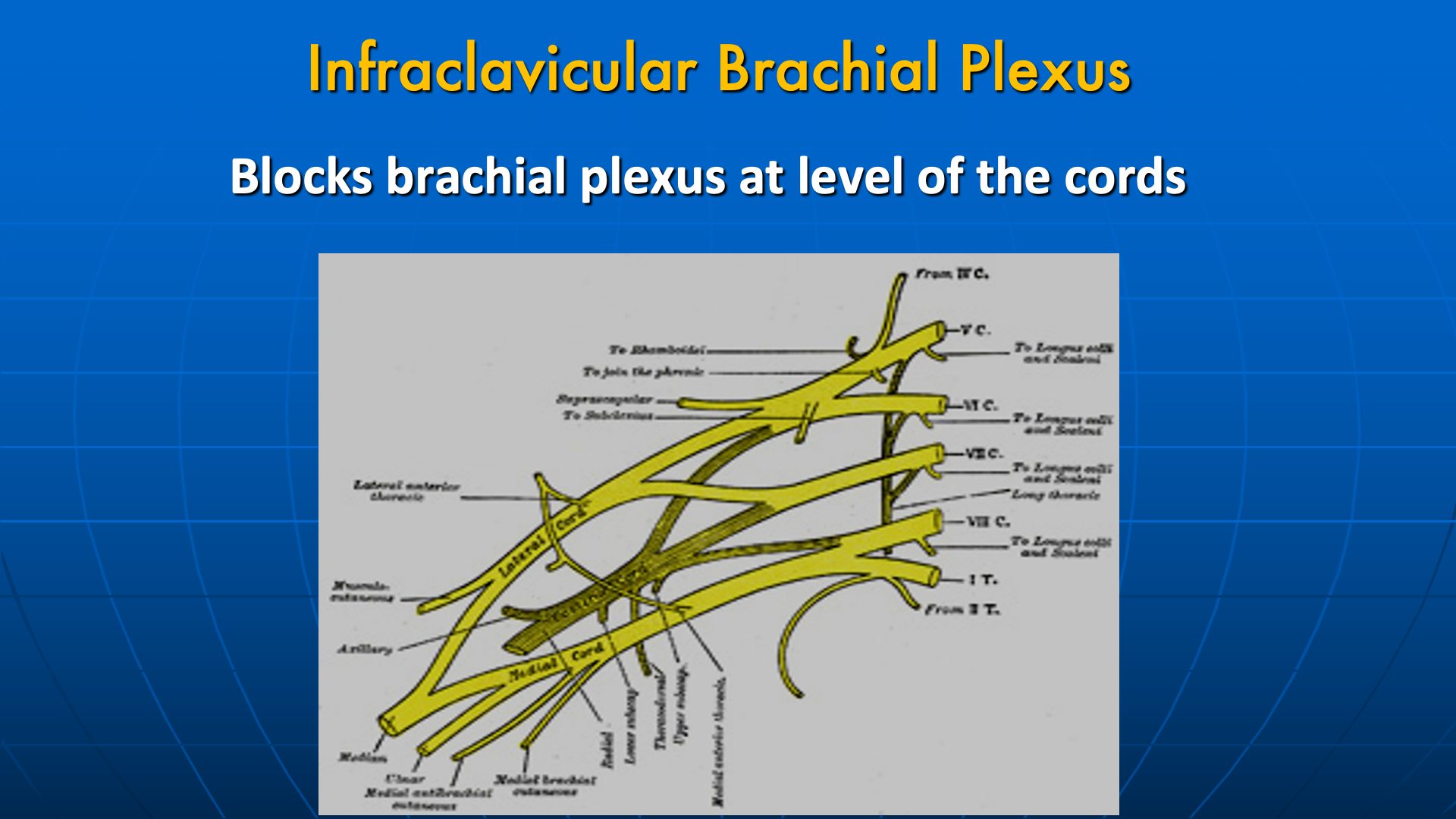 Learn How to Perform Ultrasound-Guided Brachial Plexus Blocks | Clarius ...