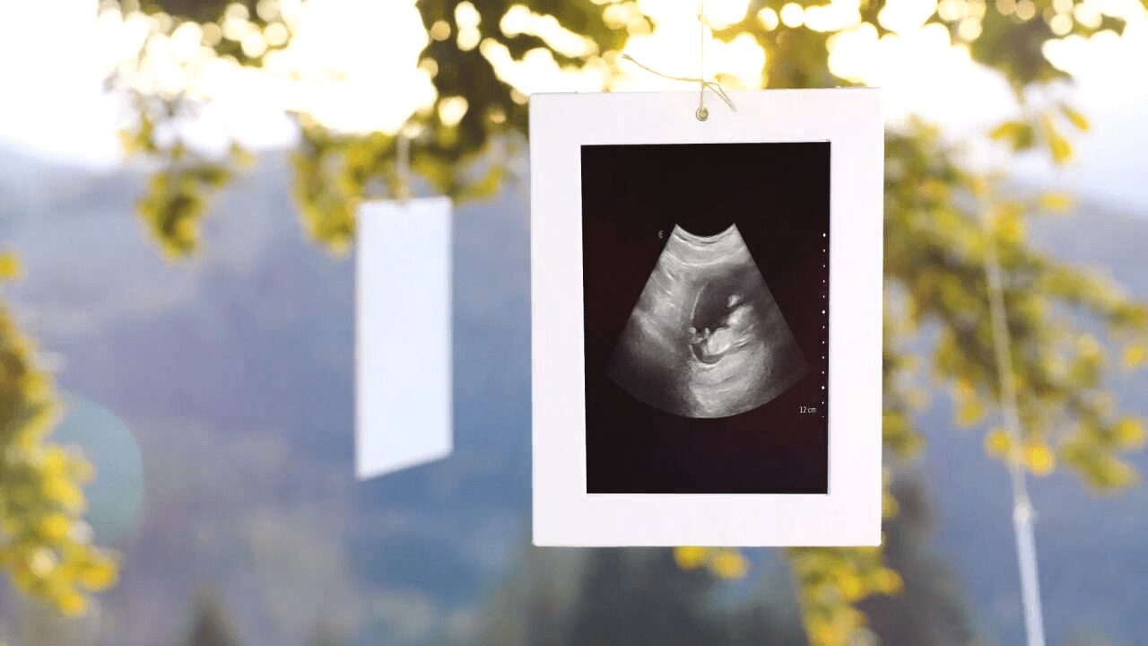 Clarius Act One™ Movie Sample | Clarius