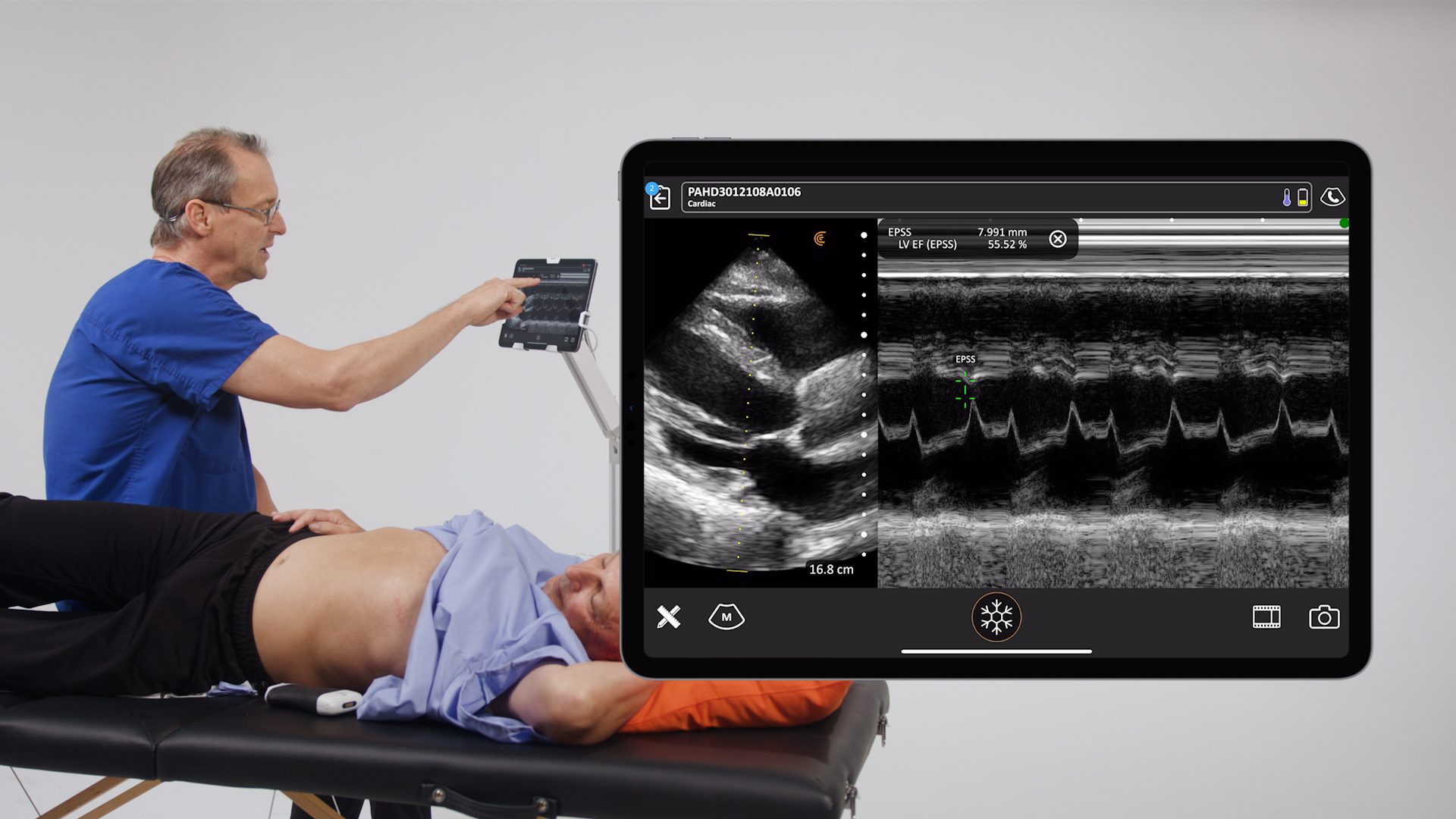 Using EPSS to Assess LV Function | Clarius