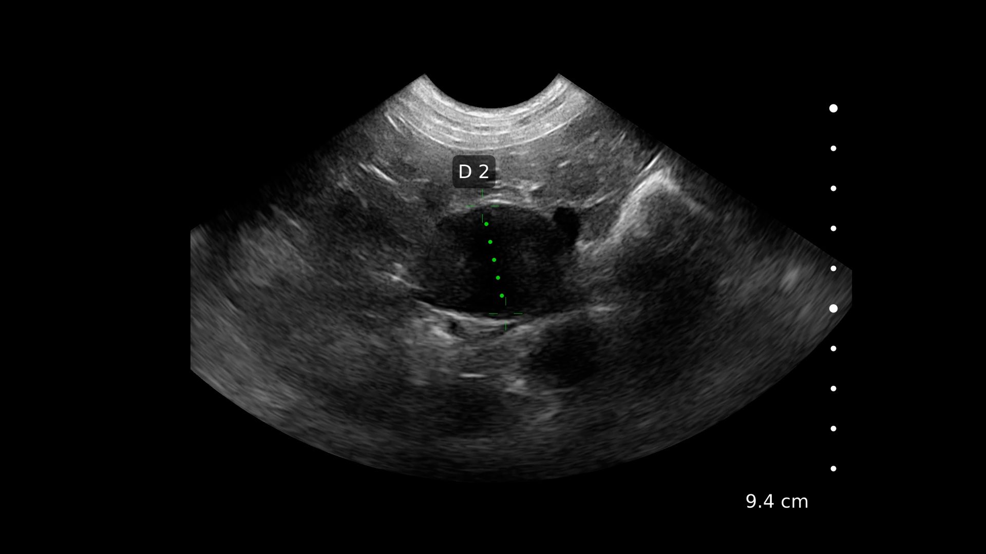 Veterinary POCUS Adrenal Mass | Clarius