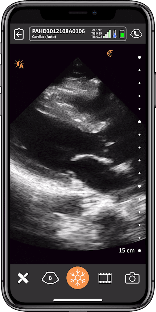 Cardiac POCUS Part 3: Resuscitation with Handheld Ultrasound | Clarius
