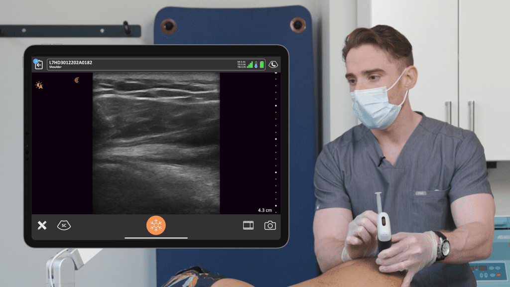 [VIDEO] Ultrasound-Guided PRP Injections: A Patient’s Hopeful Path to ...