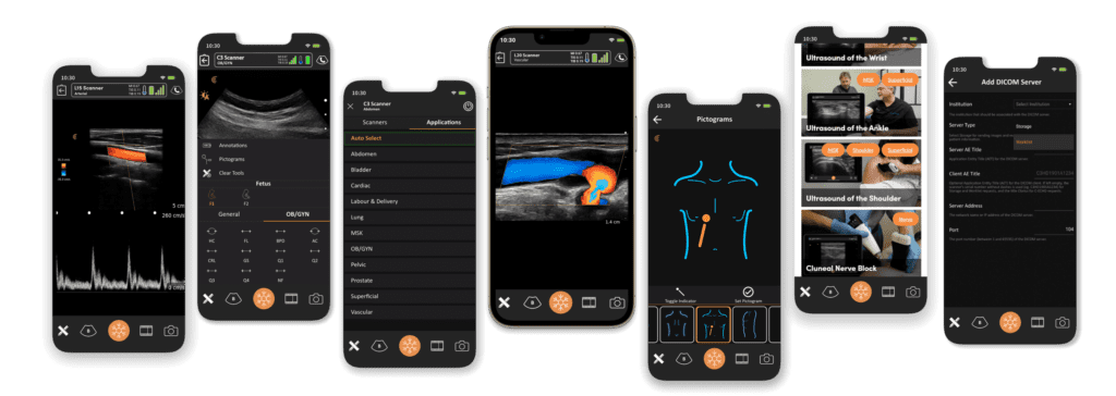 Wireless Ultrasound for Hospitalists | Clarius High-Definition Wireless Ultrasound