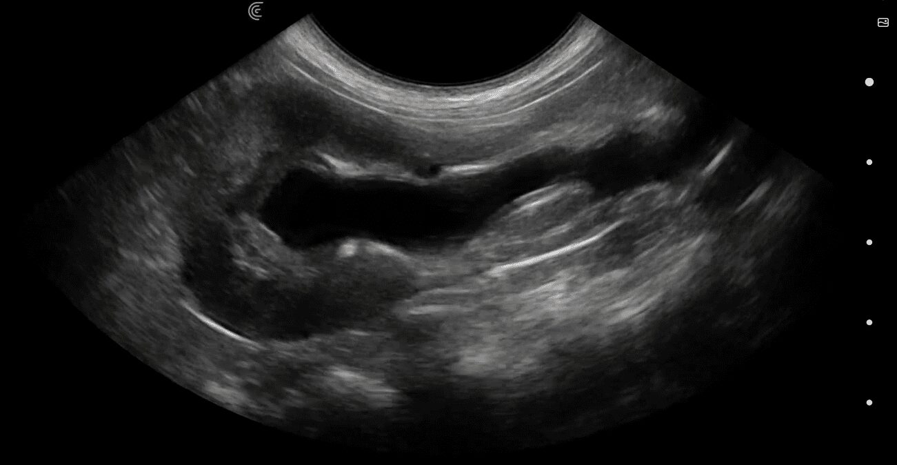 Case Study: Veterinary POCUS Pathology – Renal Obstruction | Clarius