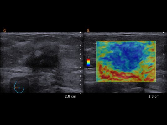 High-Frequency Linear Scanner | Clarius