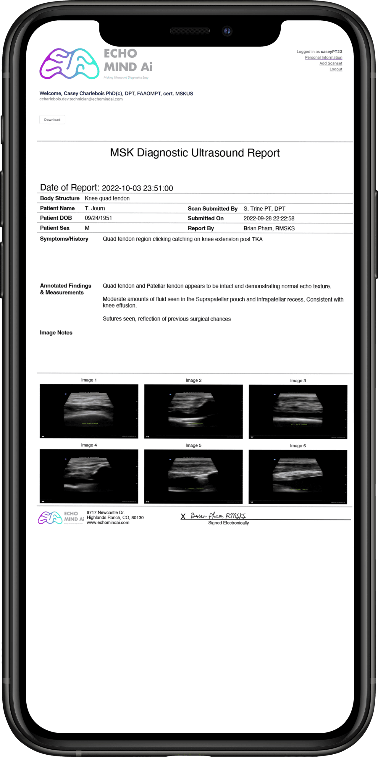 Echo Mind AI - MSK Tele-Sonography | Clarius