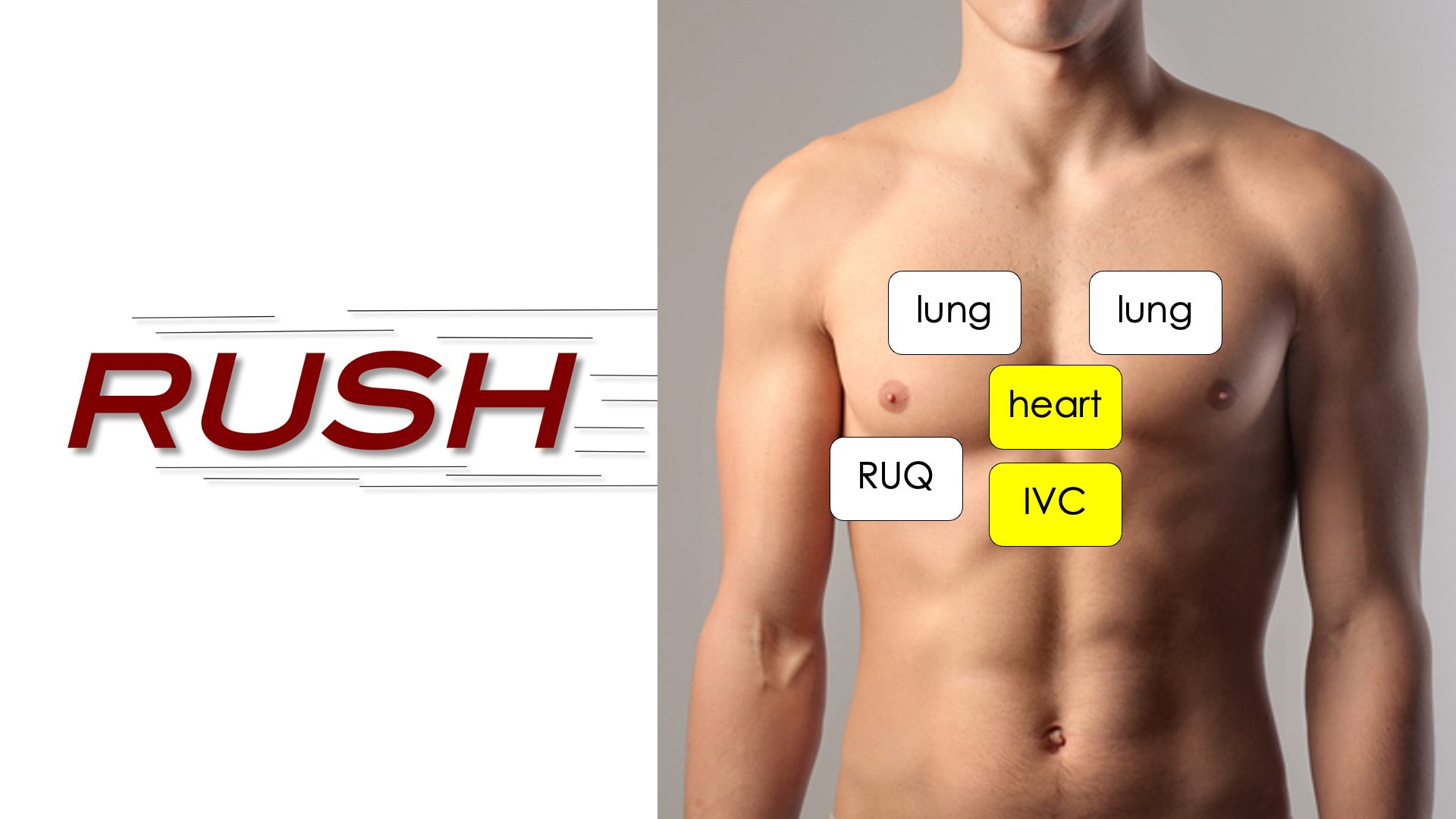 Use POCUS for the Diagnosis and Management of Shock | Clarius