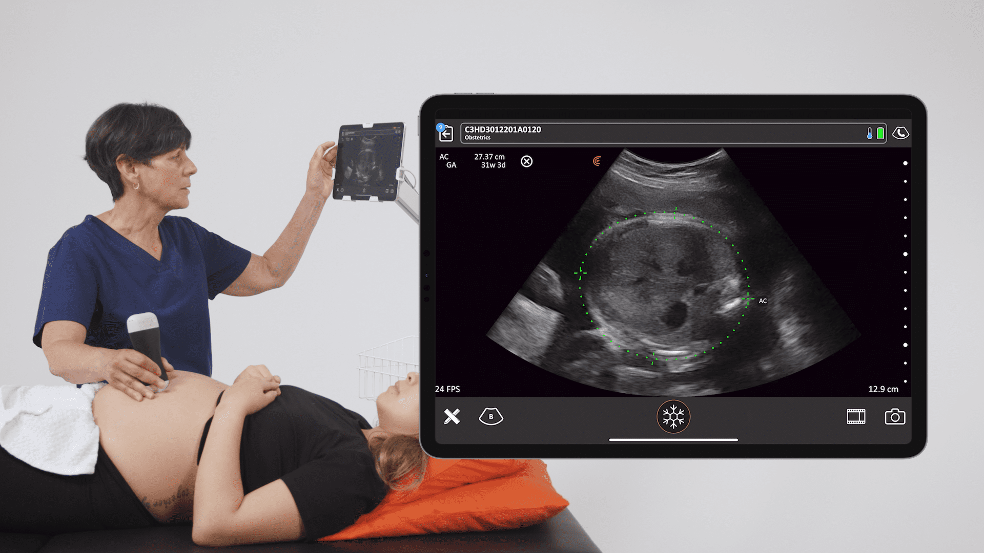 Fetal Abdominal Circumference | Clarius