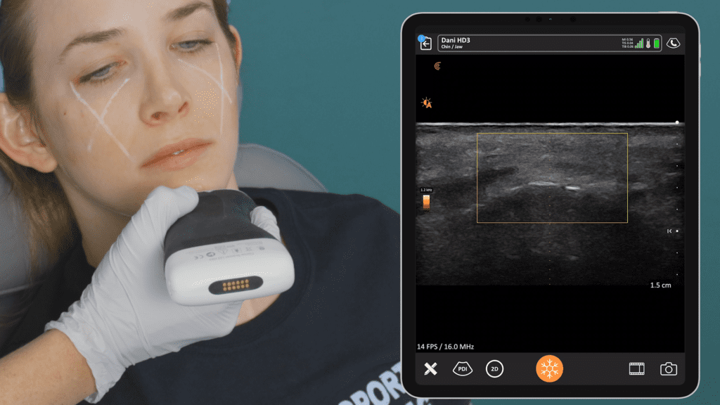 [VIDEO] Pioneering Aesthetic Injector’s Safe Mapping™ Technique Reduces ...
