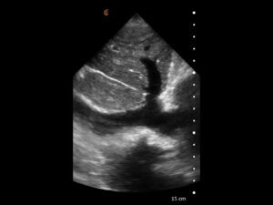 HD Ultra-portable Ultrasound | Clarius