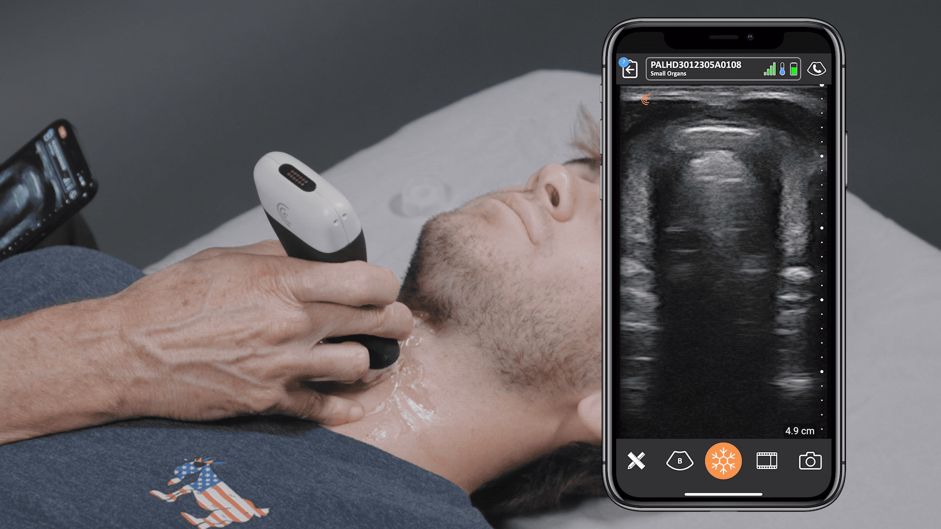 Pocus To Confirm Endotracheal Tube Placement Clarius