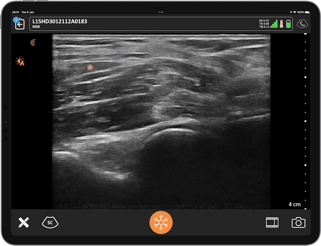 Pragmatic MSK Ultrasound: 8-Step Protocol for Assessing the Distal ...